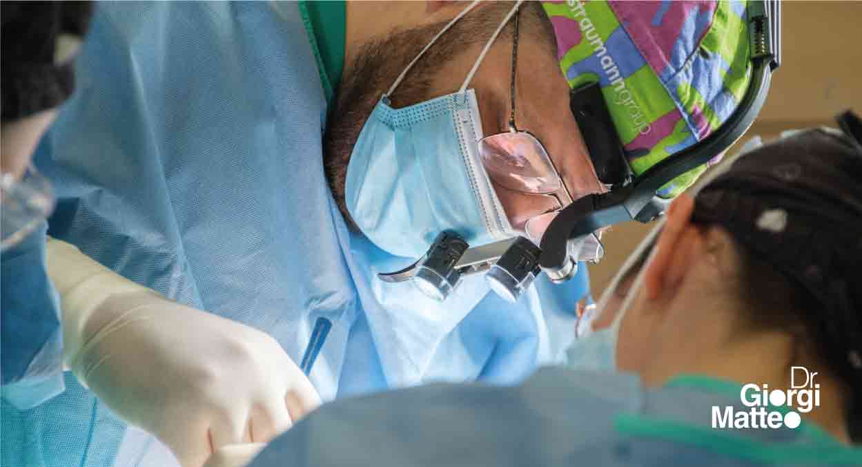 Impianti dentali per gravi atrofie osse | Dr. Matteo Giorgi